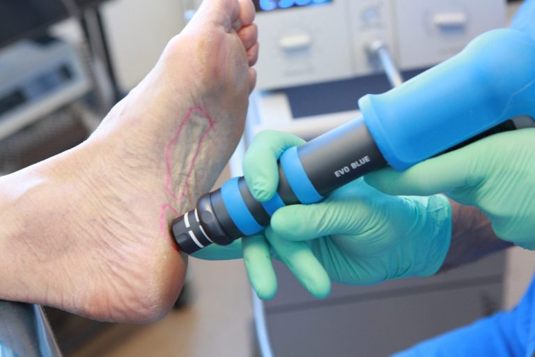 Shockwave Pain Therapy - Ottawa Foot Clinic
