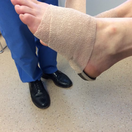 Custom-made Orthotics - Ottawa Foot Clinic